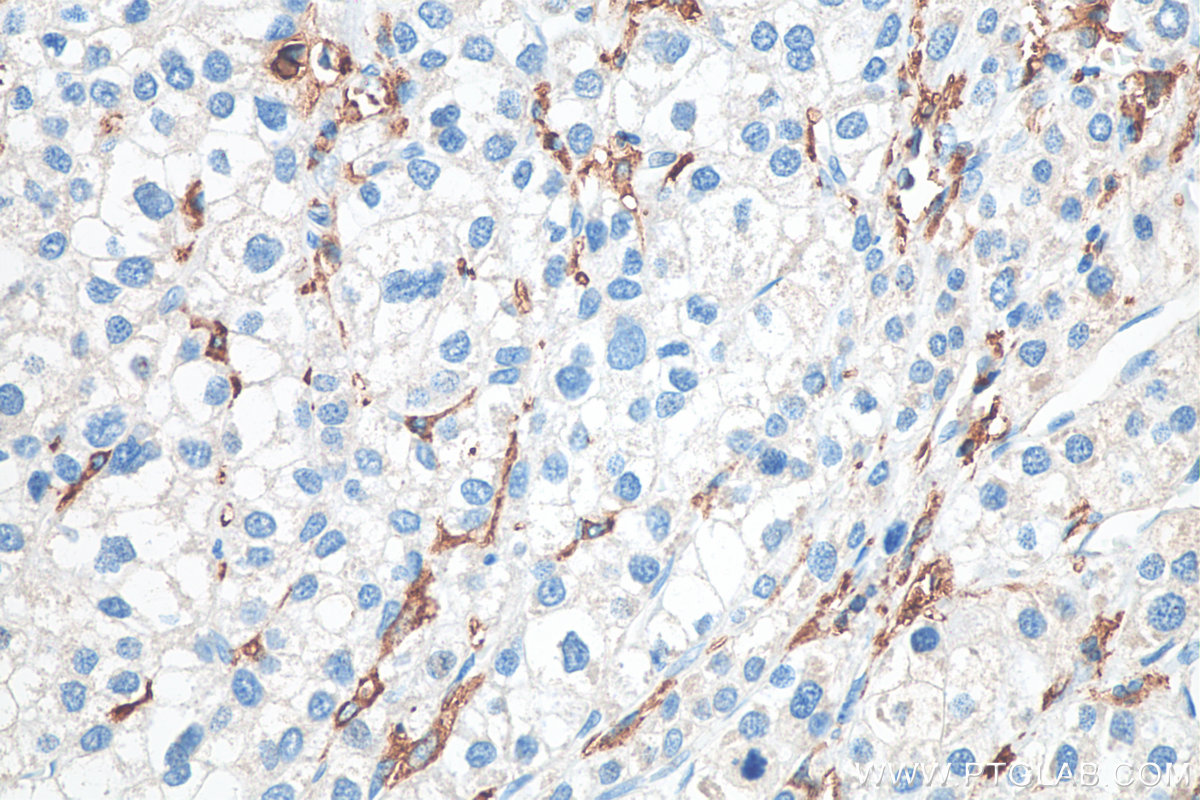 CD31 antibody (28083-1-AP) | Proteintech | 武汉三鹰生物技术有限公司