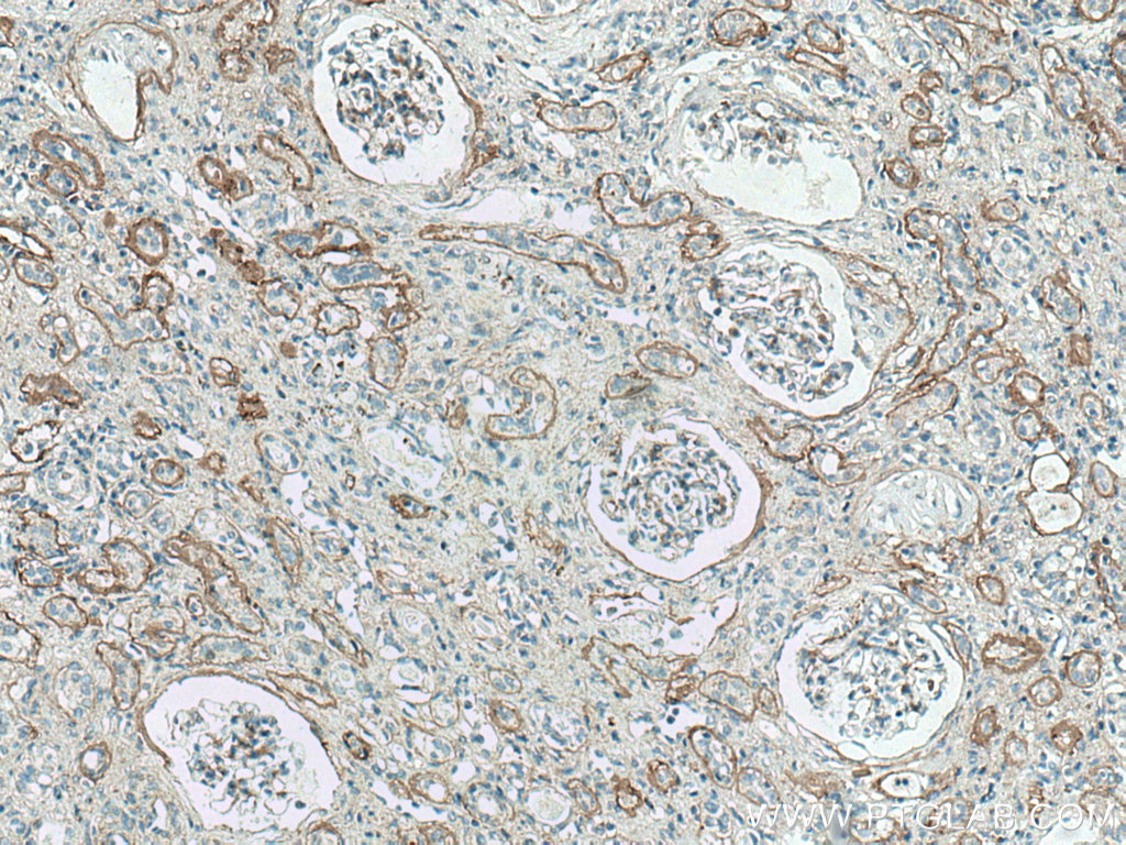 Collagen Type IV antibody (55131-1-AP) | Proteintech