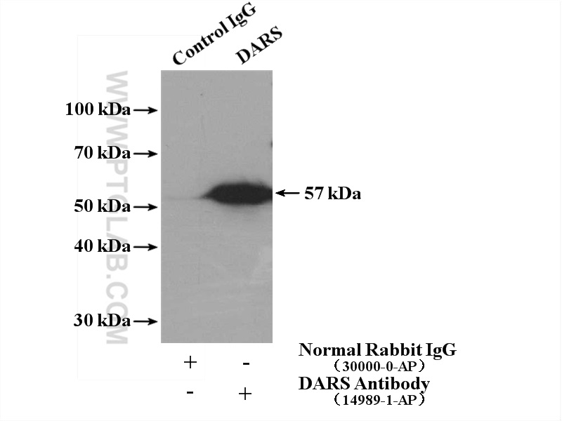 DARS antibody (14989-1-AP) | Proteintech