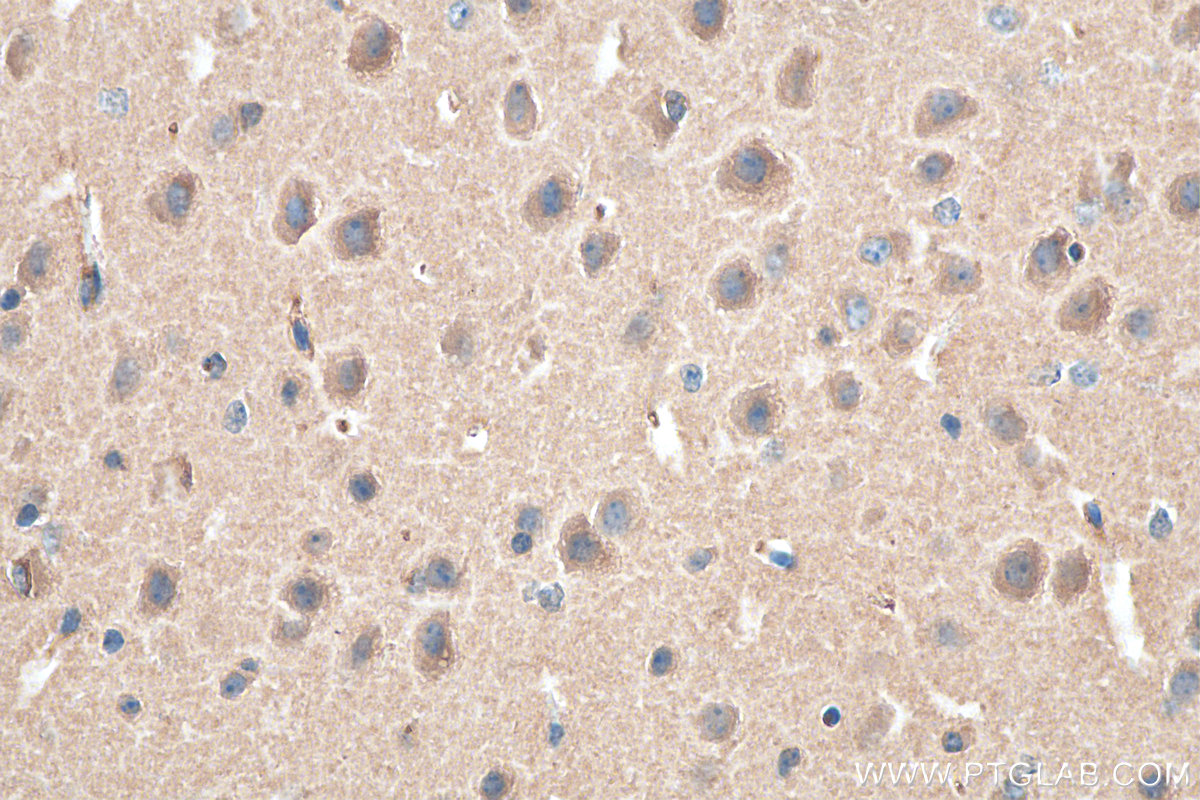 DCX antibody (13925-1-AP) | Proteintech | 武汉三鹰生物技术有限公司