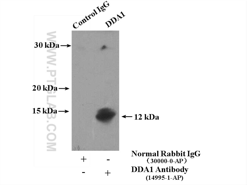 DDA1 antibody (14995-1-AP) | Proteintech | 武汉三鹰生物技术有限公司