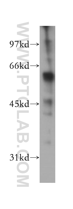 DFNA5/GSDME antibody (13075-1-AP) | Proteintech