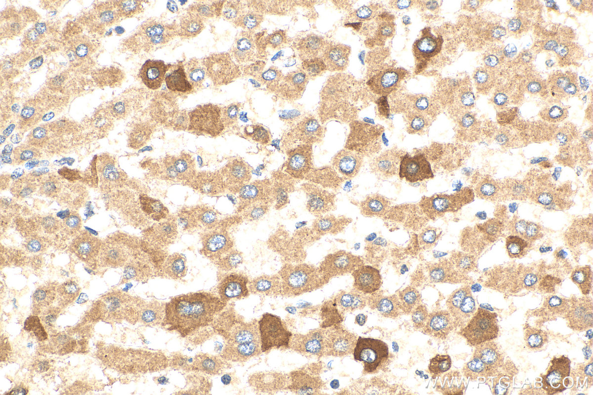 DGAT1 antibody (11561-1-AP) | Proteintech | 武汉三鹰生物技术有限公司