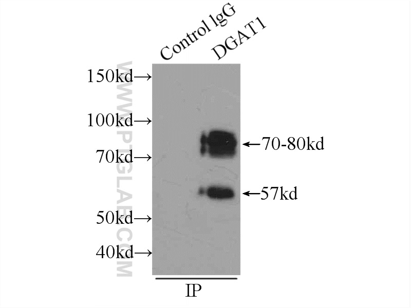 DGAT1 antibody (11561-1-AP) | Proteintech | 武汉三鹰生物技术有限公司