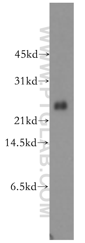 ARHI antibody (10811-2-AP) | Proteintech | 武汉三鹰生物技术有限公司