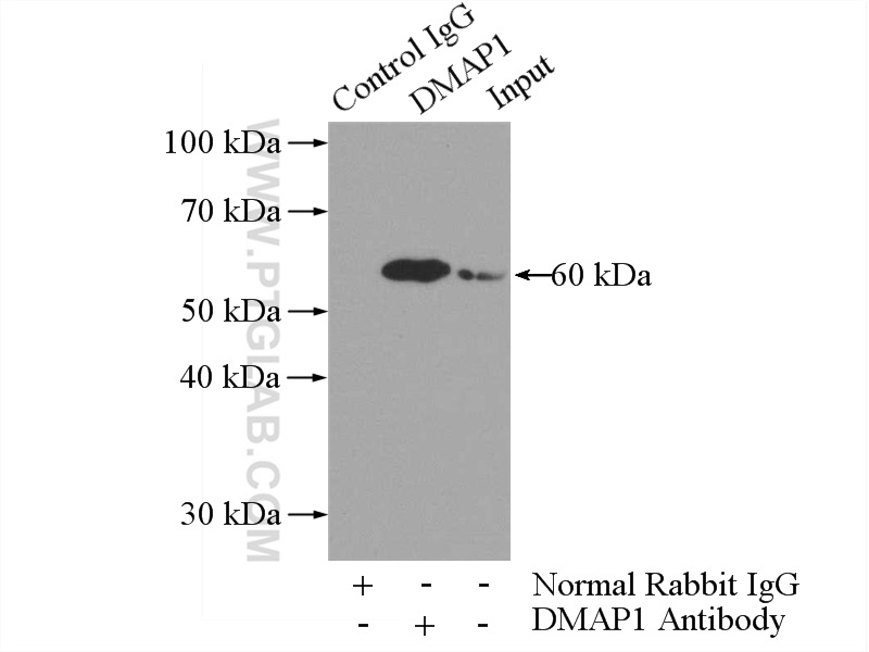 DMAP1 antibody (10411-1-AP) | Proteintech | 武汉三鹰生物技术有限公司