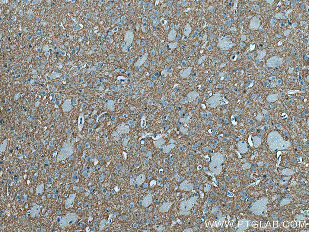 DRD1 antibody (17934-1-AP) | Proteintech | 武汉三鹰生物技术有限公司