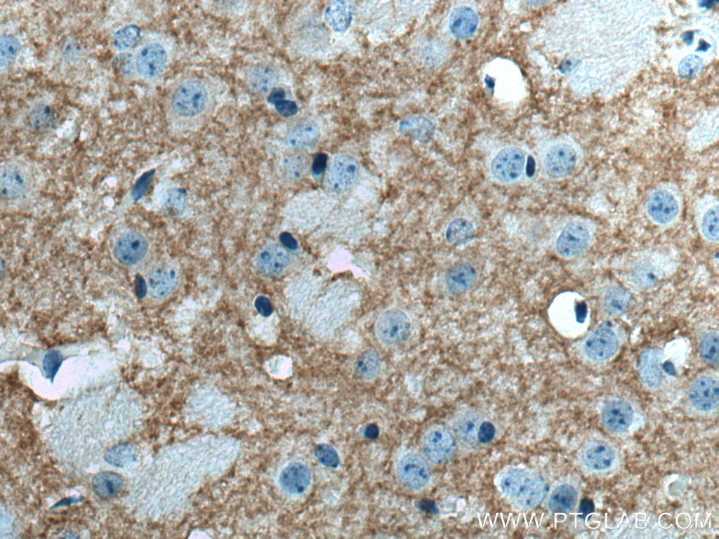 DRD1 antibody (17934-1-AP) | Proteintech | 武汉三鹰生物技术有限公司