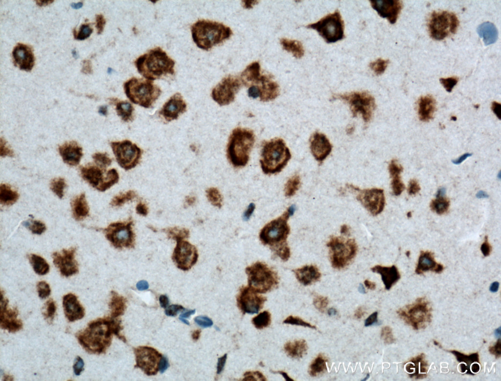 DRD2 Antibody 55084-1-AP | Proteintech