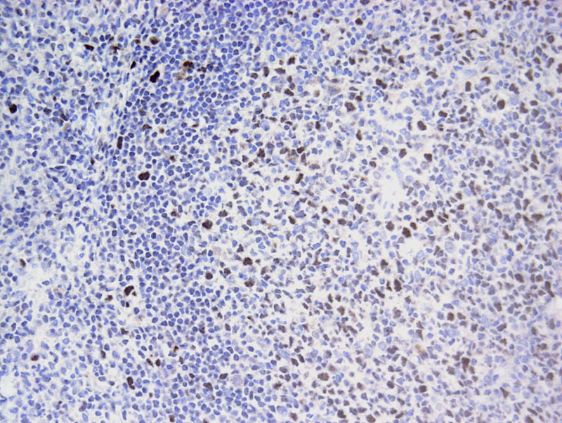 EED antibody (mAb) (Clone 41D) | Proteintech | 武汉三鹰生物技术有限公司