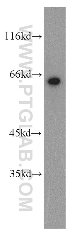 ATF4 antibody (60035-1-Ig) | Proteintech | 武汉三鹰生物技术有限公司