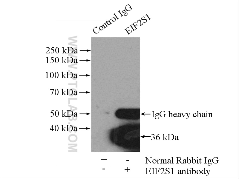 EIF2S1/EIF2A Antibody 11170-1-AP | Proteintech