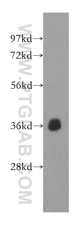 EIF2S1/EIF2A Antibody 11170-1-AP | Proteintech