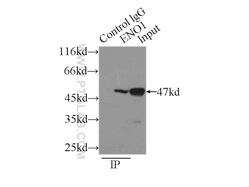 ENO1 Antibody 11204-1-AP | Proteintech