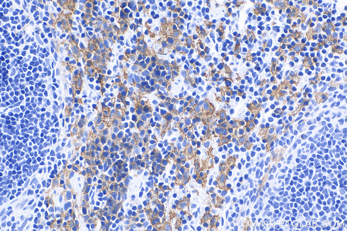 F4/80 antibody (28463-1-AP) | Proteintech | 武汉三鹰生物技术有限公司