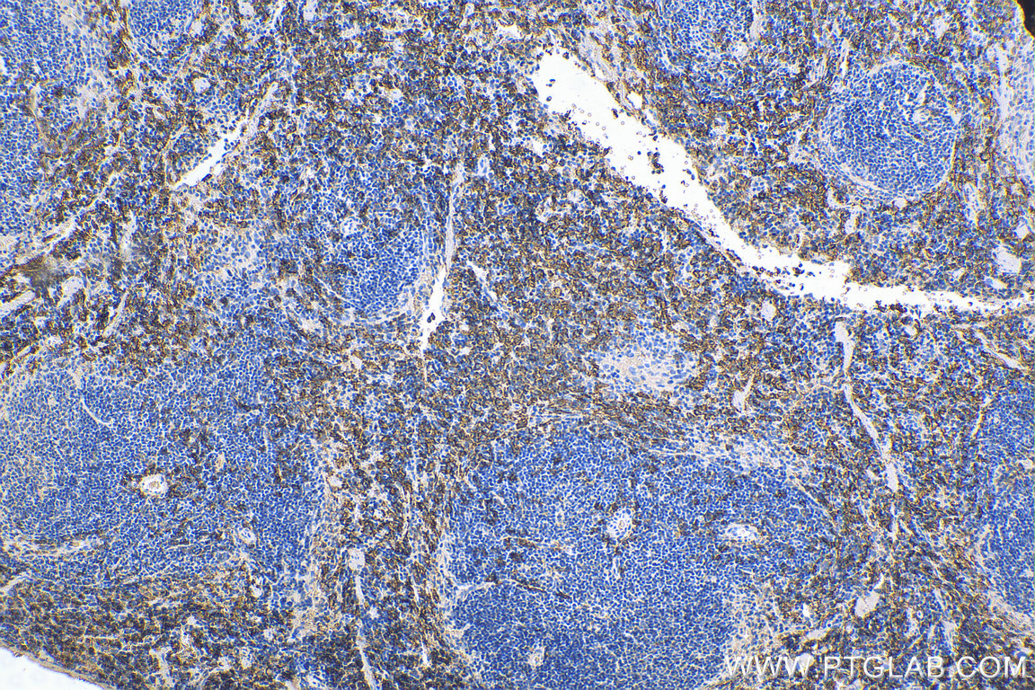 F4/80 antibody (29414-1-AP) | Proteintech
