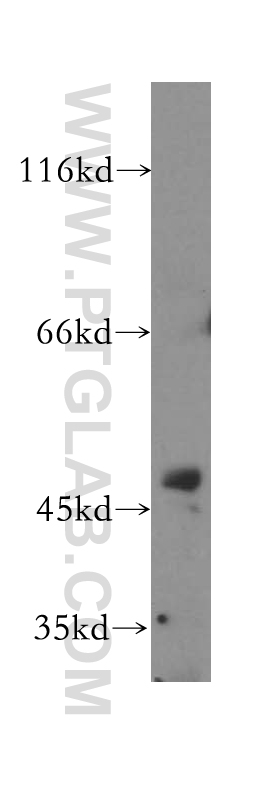 FARS2 antibody (16436-1-AP) | Proteintech | 武汉三鹰生物技术有限公司