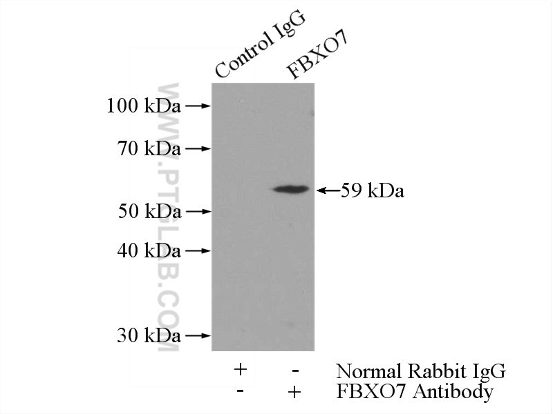 FBXO7 antibody (10696-1-AP) | Proteintech | 武汉三鹰生物技术有限公司