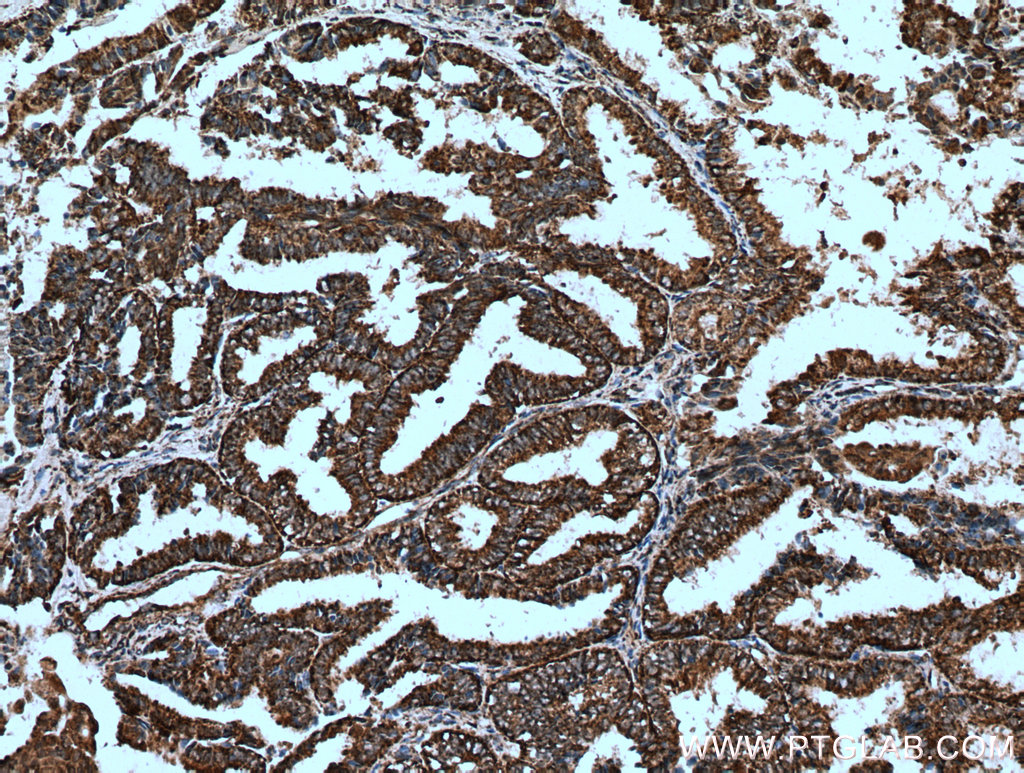 FH Antibody 11375-1-AP | Proteintech