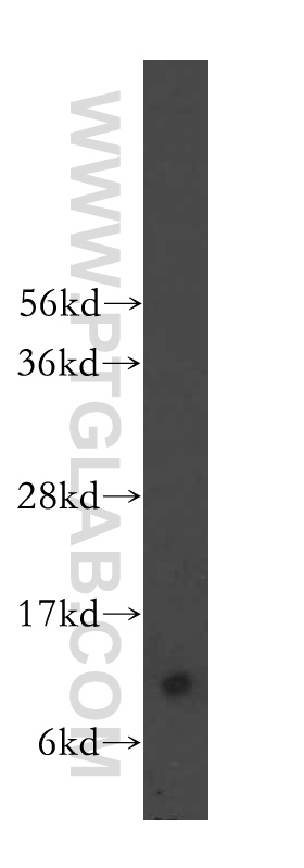 FKBP1A antibody (10273-1-AP) | Proteintech | 武汉三鹰生物技术有限公司