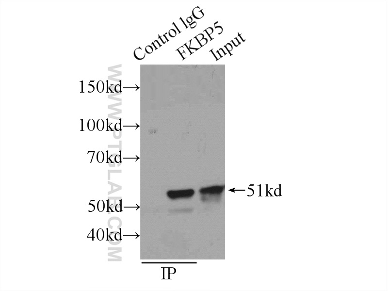 FKBP5 antibody (14155-1-AP) | Proteintech | 武汉三鹰生物技术有限公司
