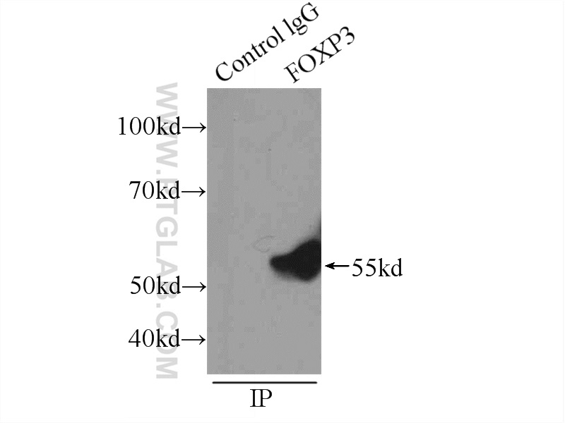 FOXP3 antibody (22228-1-AP) | Proteintech | 武汉三鹰生物技术有限公司