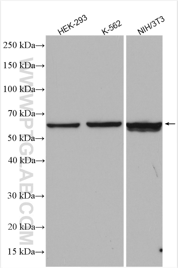 FRK antibody (16197-1-AP) | Proteintech | 武汉三鹰生物技术有限公司