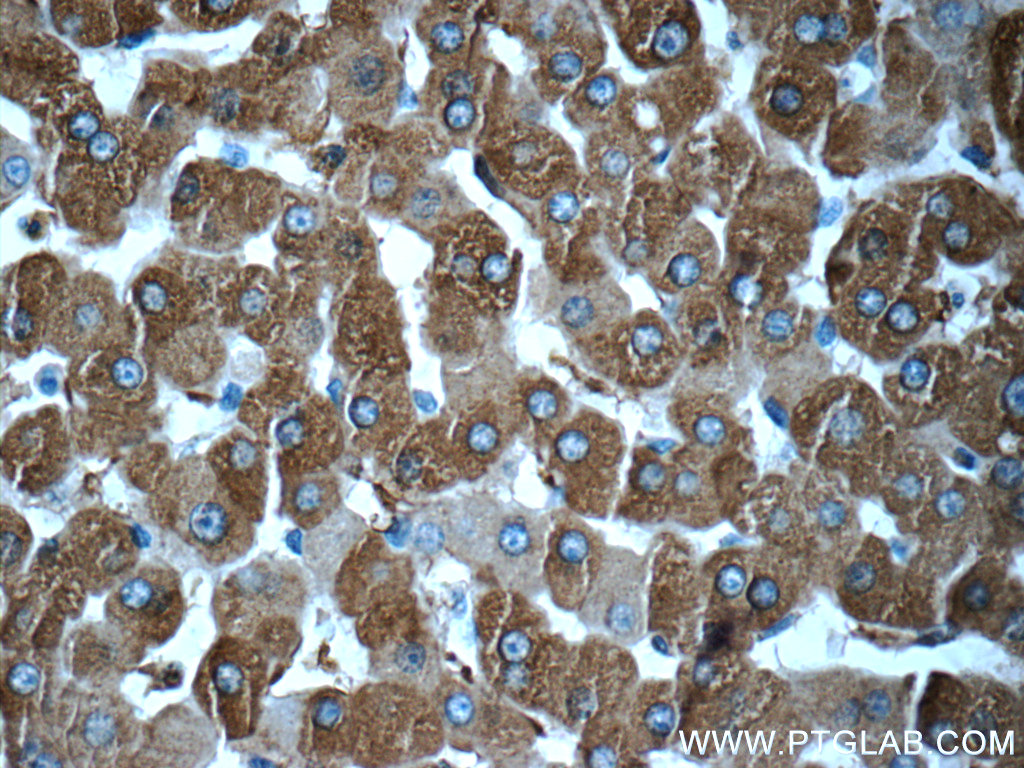Ferritin light chain Antibody 10727-1-AP | Proteintech
