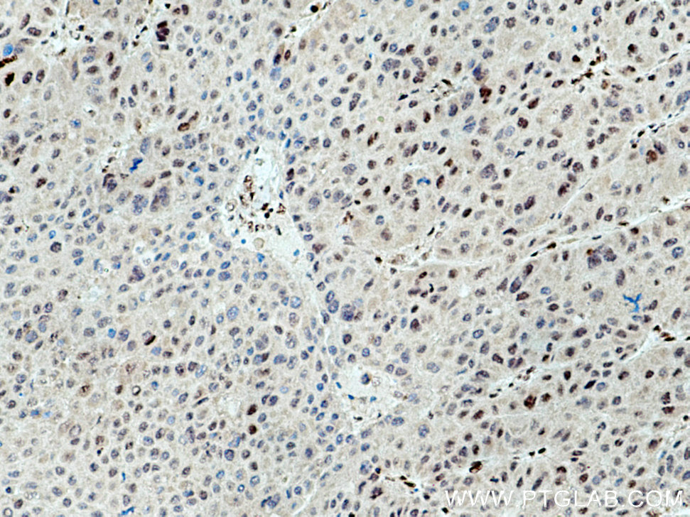 FTO Antibody 27226-1-AP | Proteintech