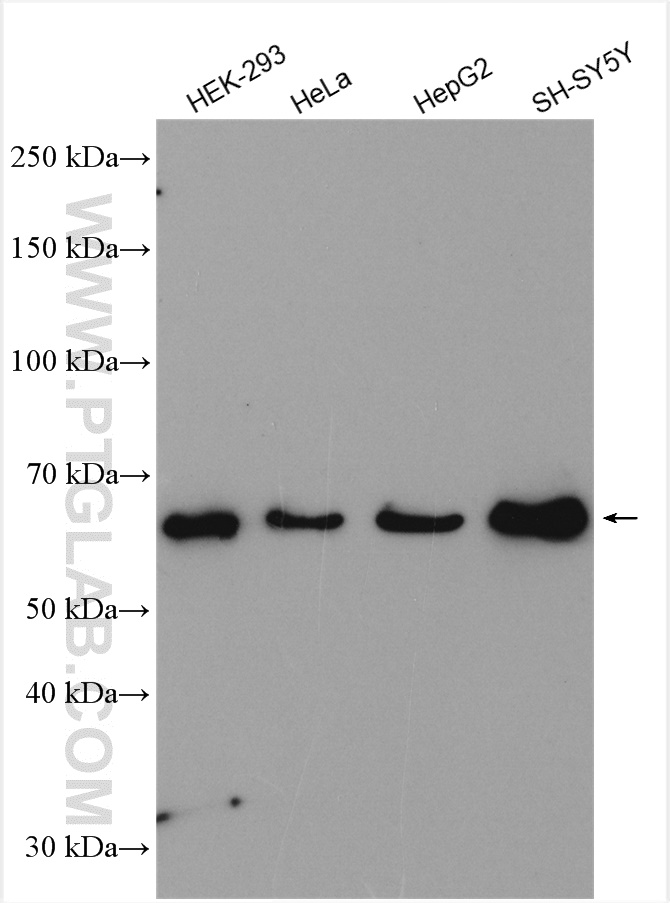 FUS/TLS antibody (11570-1-AP) | Proteintech | 武汉三鹰生物技术有限公司