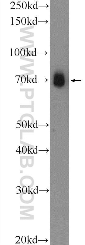 FUS/TLS Antibody 11570-1-AP | Proteintech