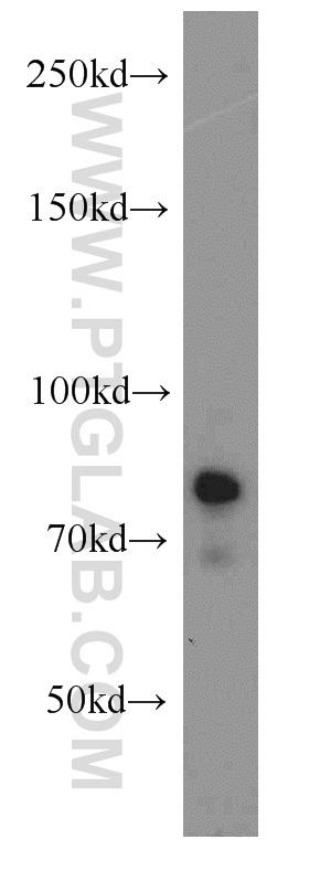 FXR1 Antibody 13194-1-AP | Proteintech
