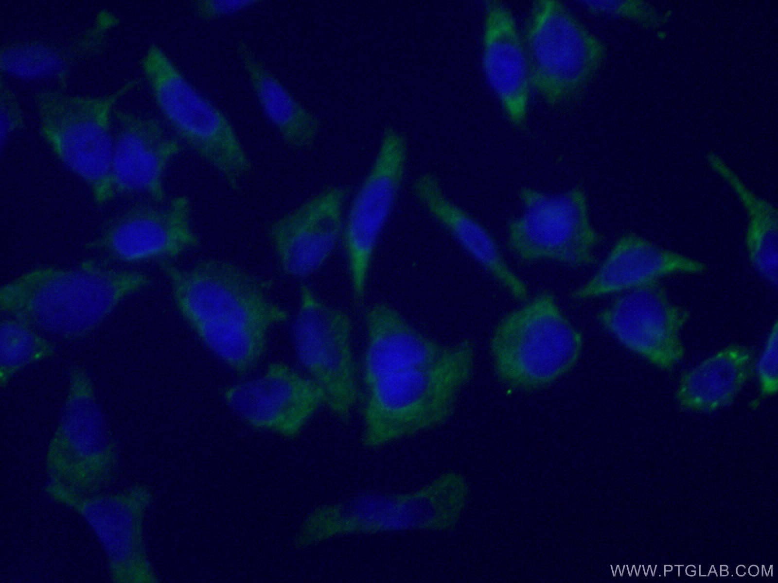 G3BP1 Antibody 66486-1-Ig | Proteintech