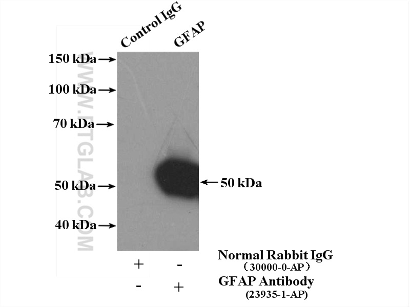 GFAP Fusion Protein Ag10452 | Proteintech | 武汉三鹰生物技术有限公司
