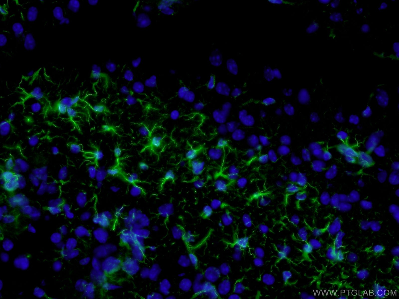 GFAP antibody (60190-1-Ig) | Proteintech