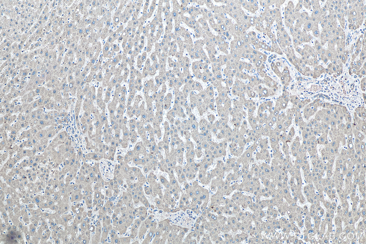 GLUD1 antibody (14299-1-AP) | Proteintech | 武汉三鹰生物技术有限公司