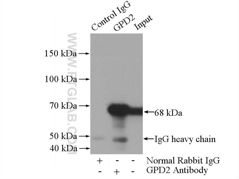 GPD2 antibody (17219-1-AP) | Proteintech | 武汉三鹰生物技术有限公司