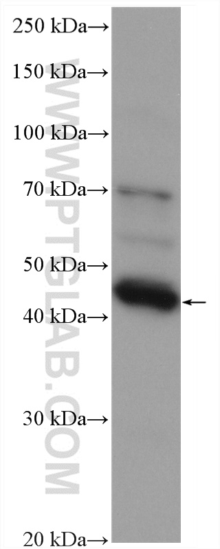 GPRC5A,RAI3 Antibody 10309-1-AP | Proteintech