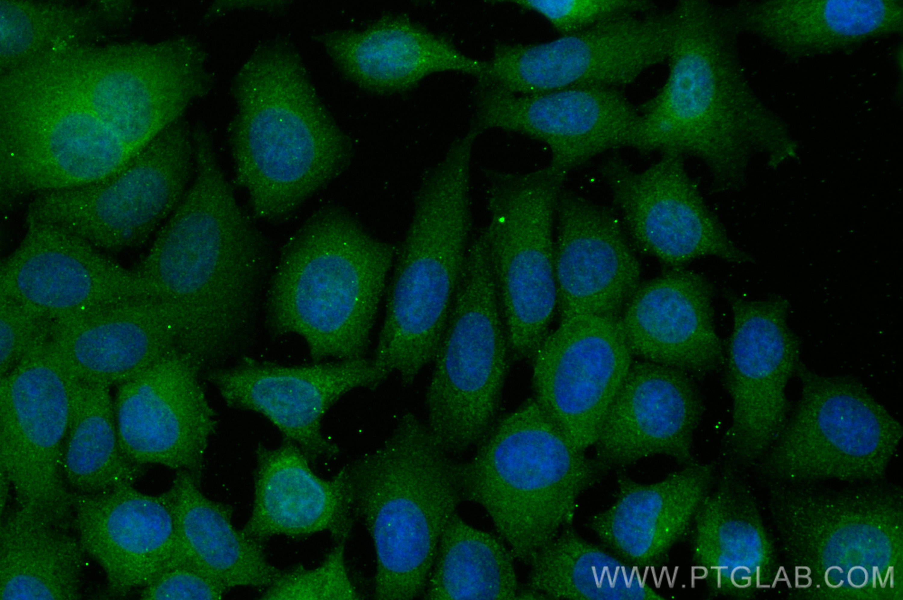 GSK3B antibody (22104-1-AP) | Proteintech | 武汉三鹰生物技术有限公司