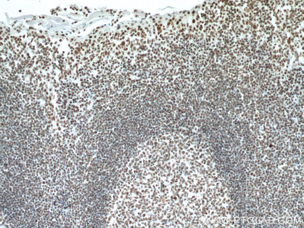 Phospho-Histone H3 (Ser10) antibody (66863-1-Ig) | Proteintech