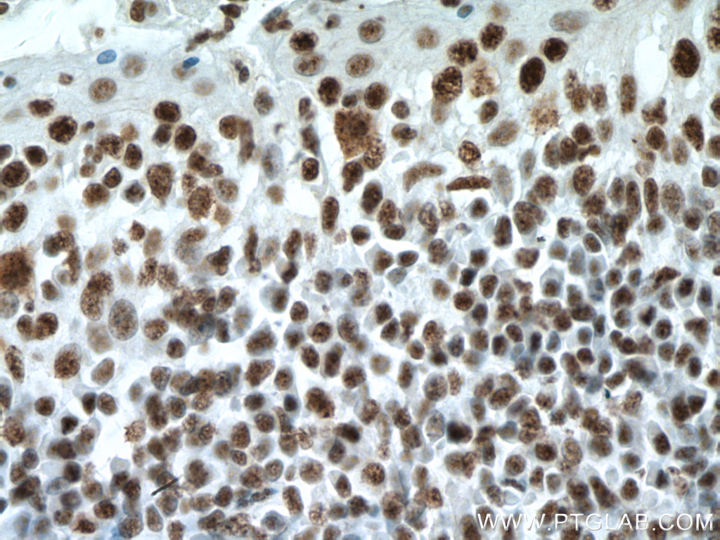Phospho-Histone H3 (Ser10) antibody (66863-1-Ig) | Proteintech | 武汉三鹰生物 ...