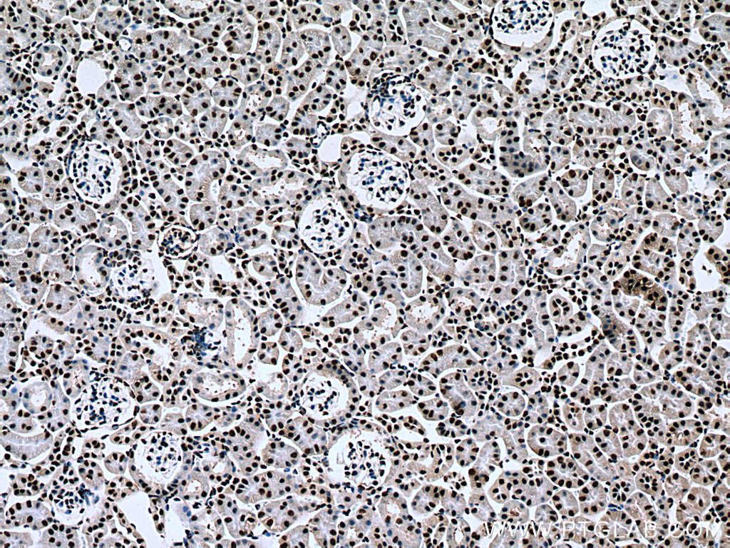 Phospho-Histone H3 (Ser10) antibody (66863-1-Ig) | Proteintech | 武汉三鹰生物 ...