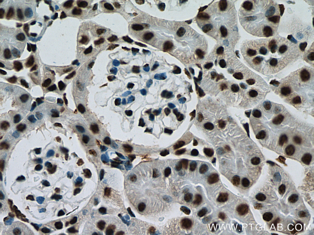 Phospho-Histone H3 (Ser10) antibody (66863-1-Ig) | Proteintech | 武汉三鹰生物 ...