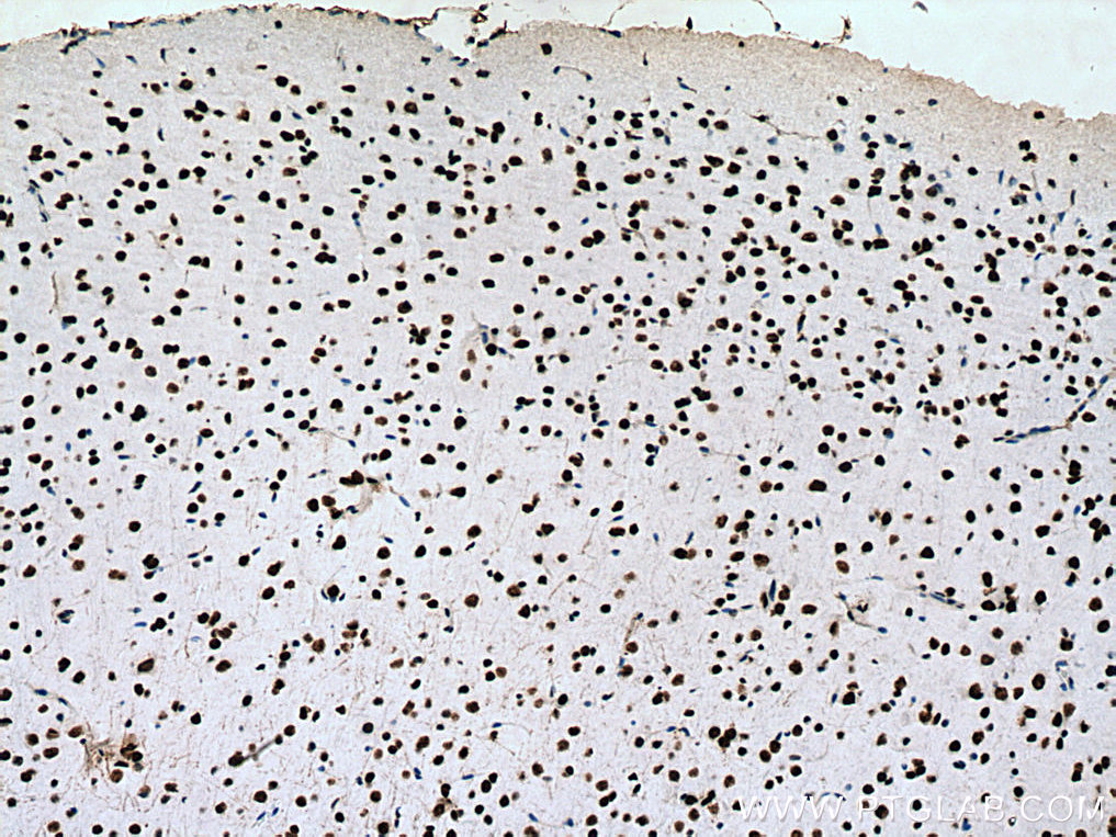 Phospho Histone H3 Ser10 Antibody 66863 1 Ig Proteintech 武汉三鹰生物技术有限公司