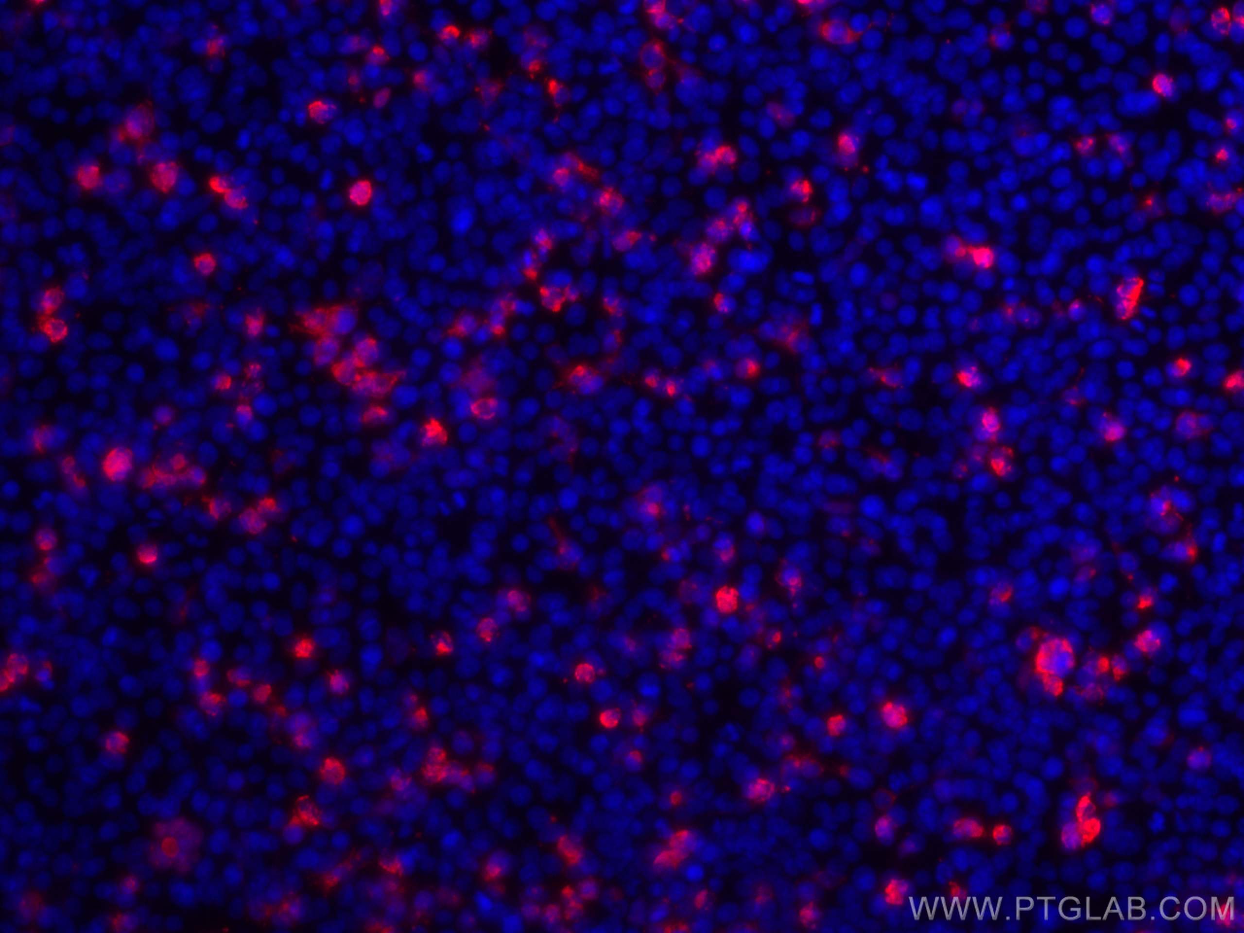HA Tag antibody (81290-1-RR) | Proteintech | 武汉三鹰生物技术有限公司
