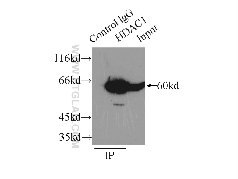 HDAC1 antibody (10197-1-AP) | Proteintech | 武汉三鹰生物技术有限公司