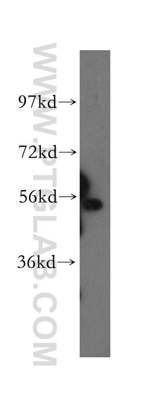 GM2A antibody (10864-2-AP) | Proteintech | 武汉三鹰生物技术有限公司