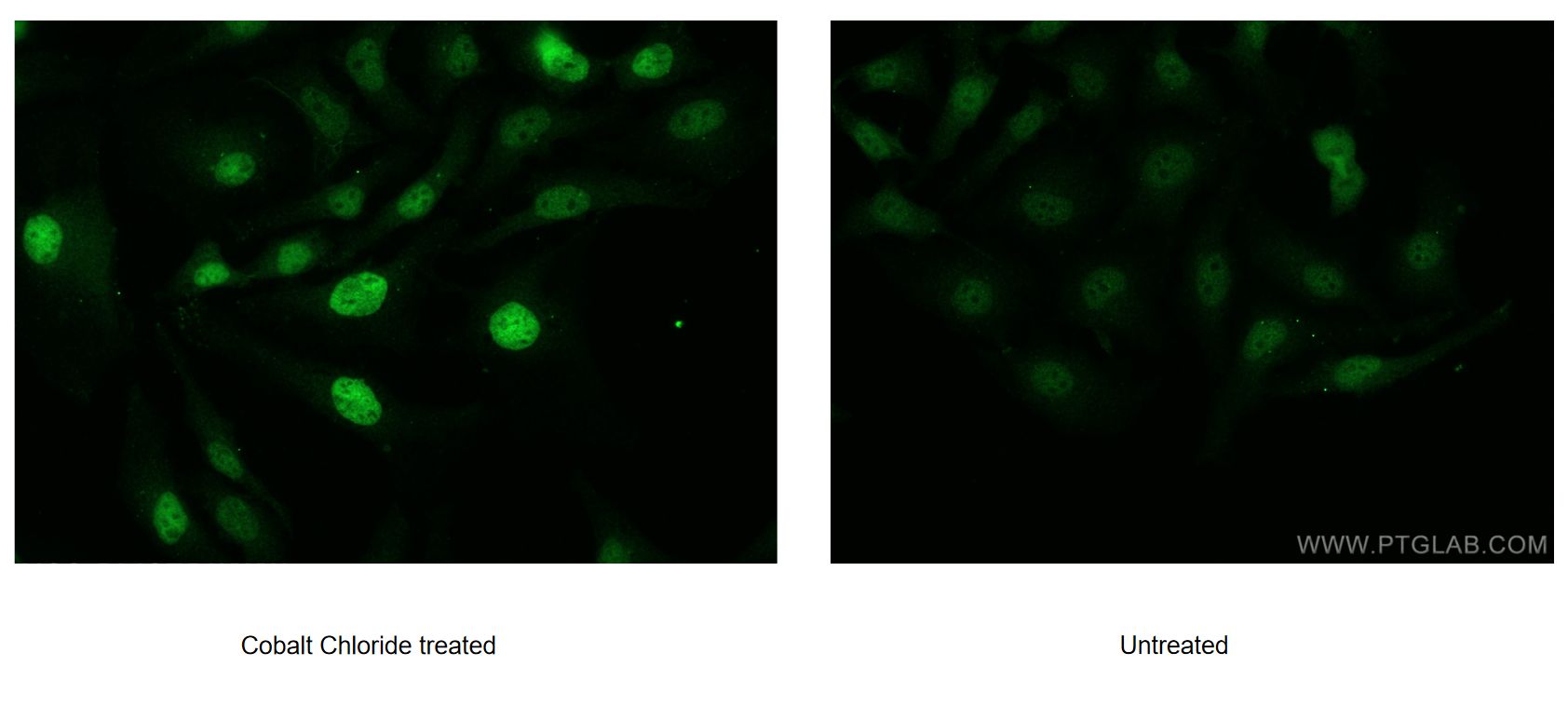 HIF1a Fusion Protein Ag15198 | Proteintech | 武汉三鹰生物技术有限公司