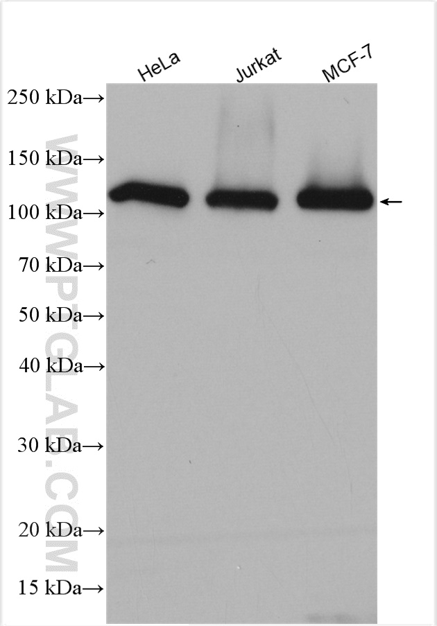 Hexokinase 2 antibody (22029-1-AP) | Proteintech