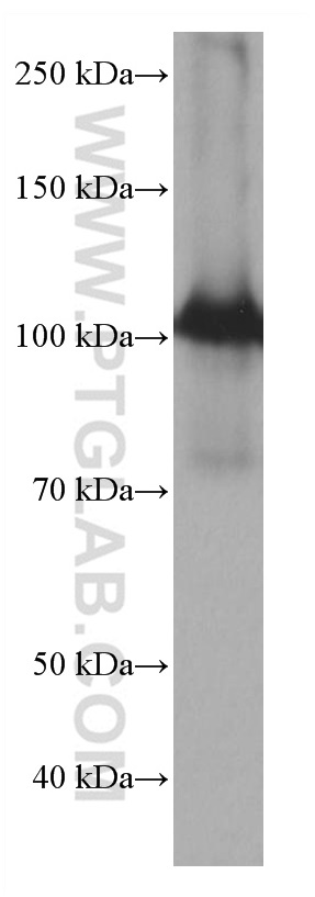 Hexokinase 2 antibody (66974-1-Ig) | Proteintech